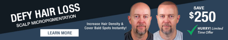 Ohio Hair Restoration & Hair Transplant Experts | Hair Replacement ...